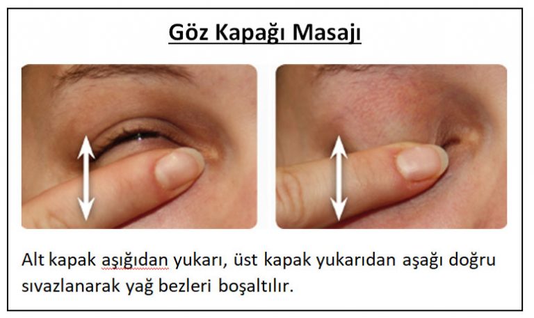 Blefarit Tedavisi Fiyatları 2025 | Prof. Dr. Gökhan GÜLKILIK